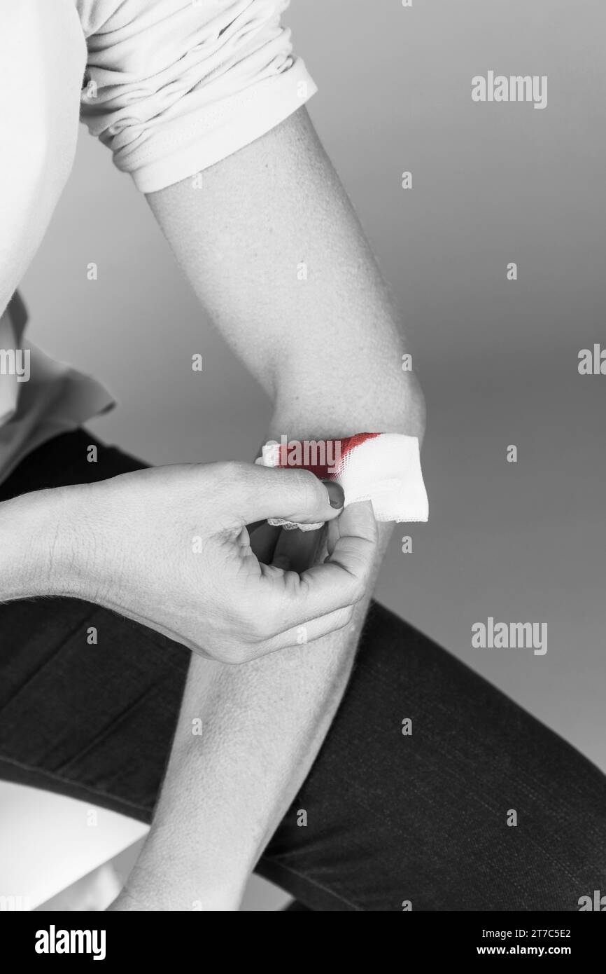 Wrist plaster hi-res stock photography and images - Alamy