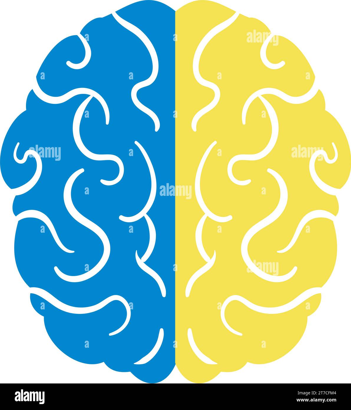 down syndrome brain condition Stock Vector Image & Art - Alamy
