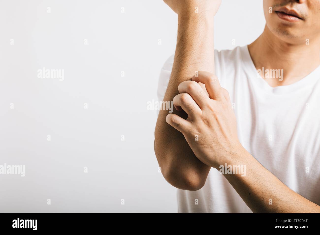 Scratching itchy skin sensitive hi-res stock photography and images - Alamy