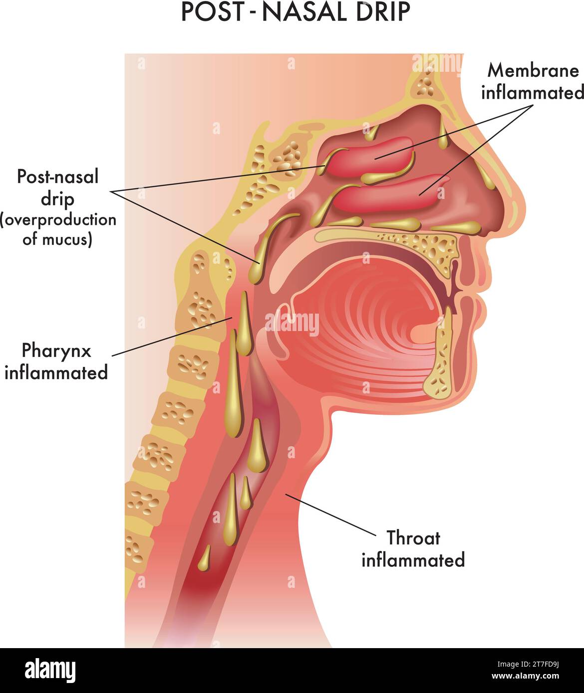Nasal Drip Online Nasal Drip Online