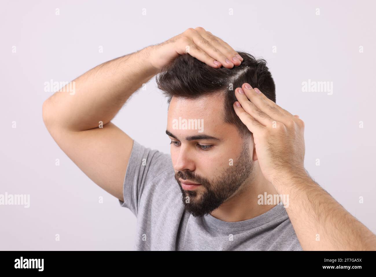Man with dandruff in his dark hair on light grey background Stock Photo ...