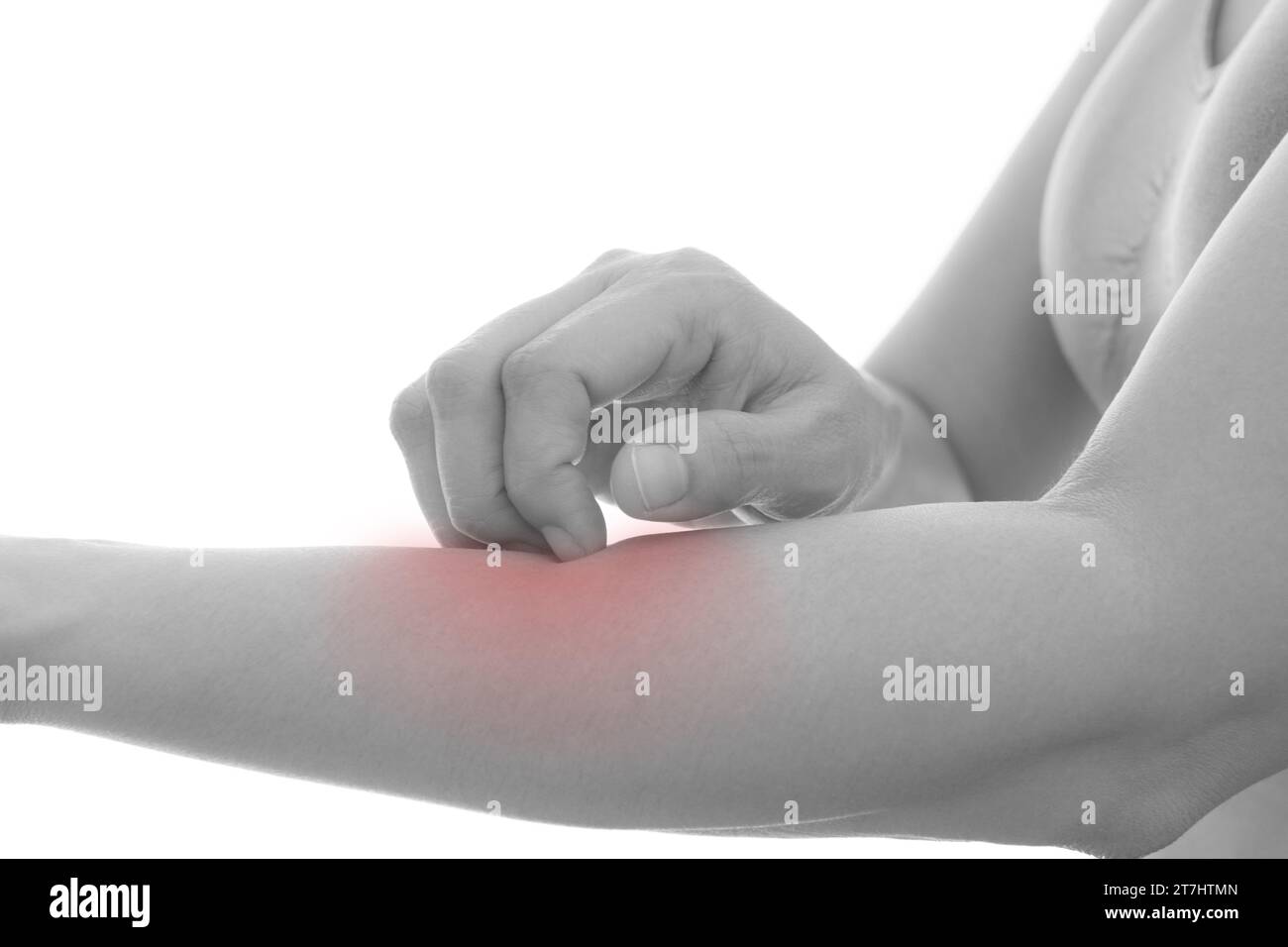 Itching of skin diseases in women using the hand-scratching. Red around ...