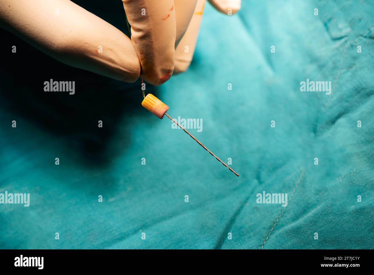 Closeup view neurosurgeon hand holding stereoelectroencephalography ...