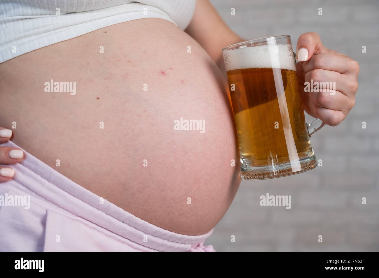 Faceless pregnant woman with rash on stomach holding glass of beer ...
