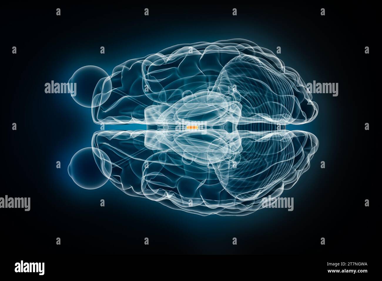 Interthalamic Adhesion X Ray Superior Or Top View 3d Rendering