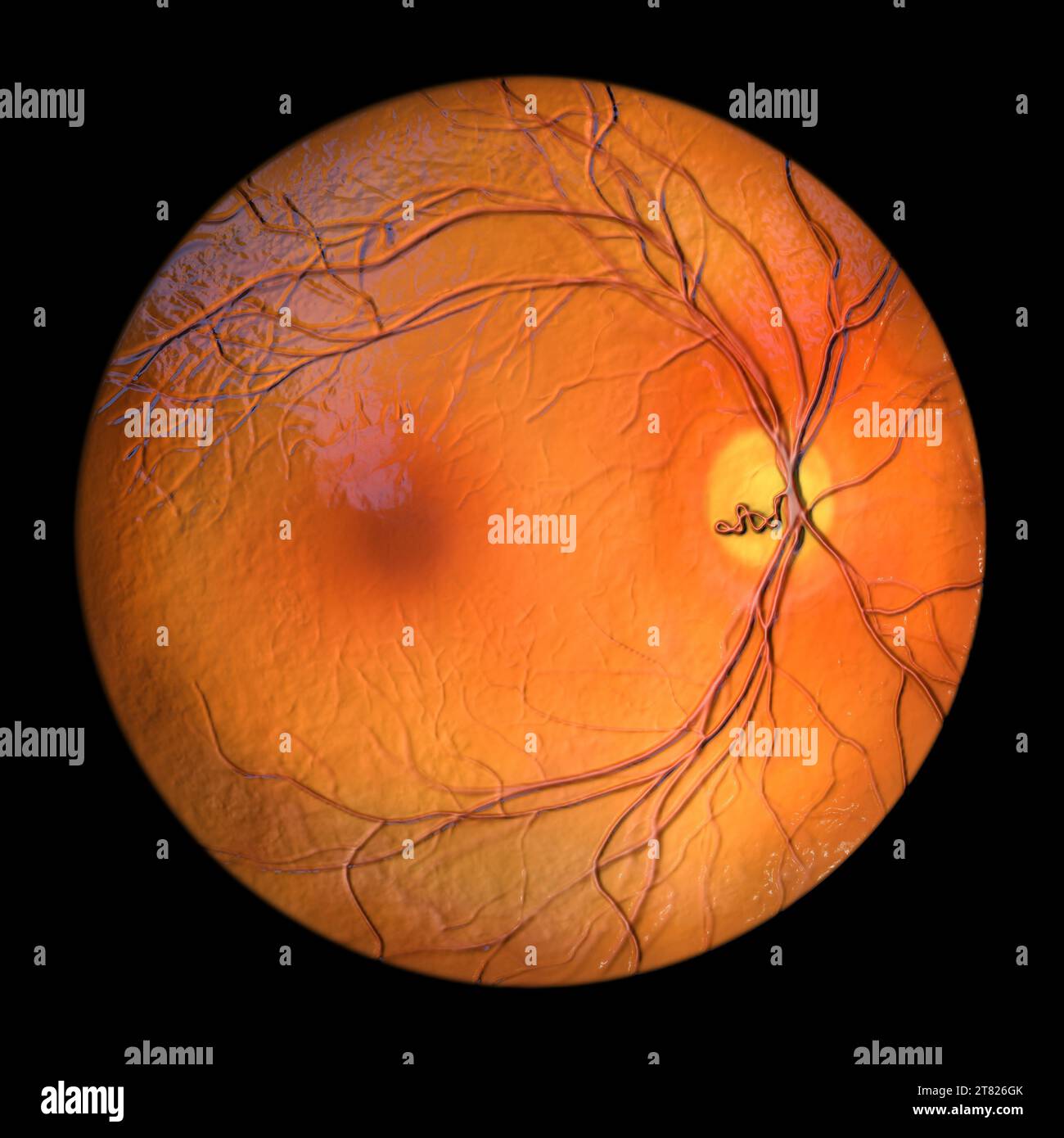 Prepapillary vascular loop on the retina, illustration Stock Photo - Alamy