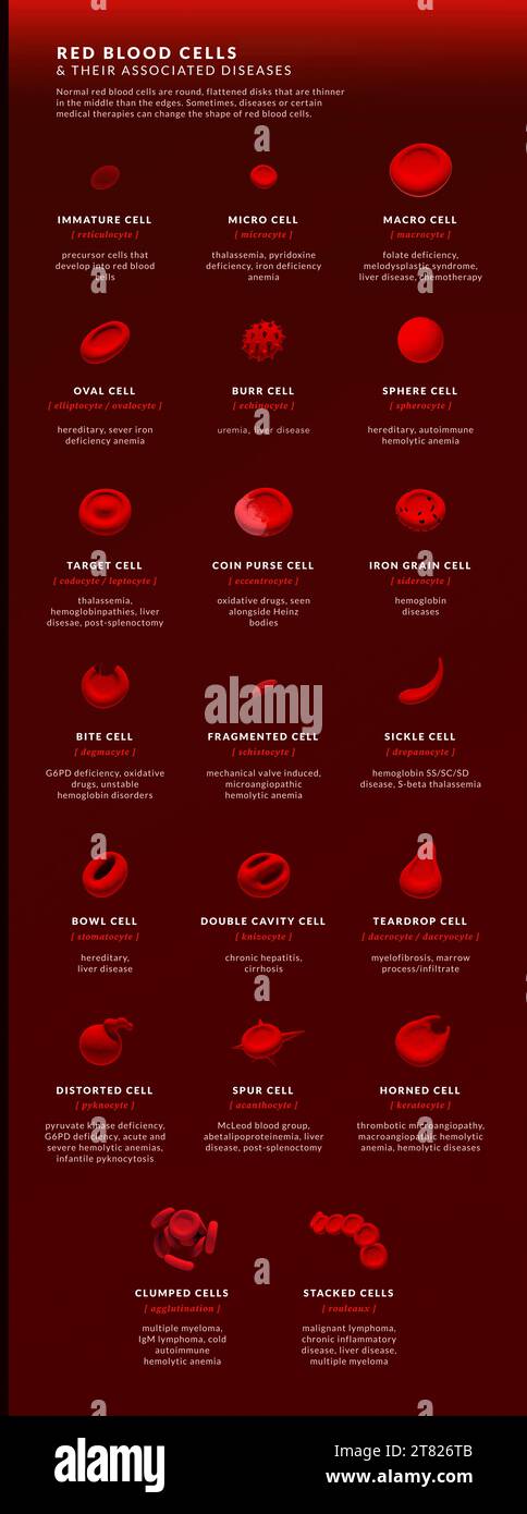 Forms of abnormal red blood cell, illustration Stock Photo - Alamy