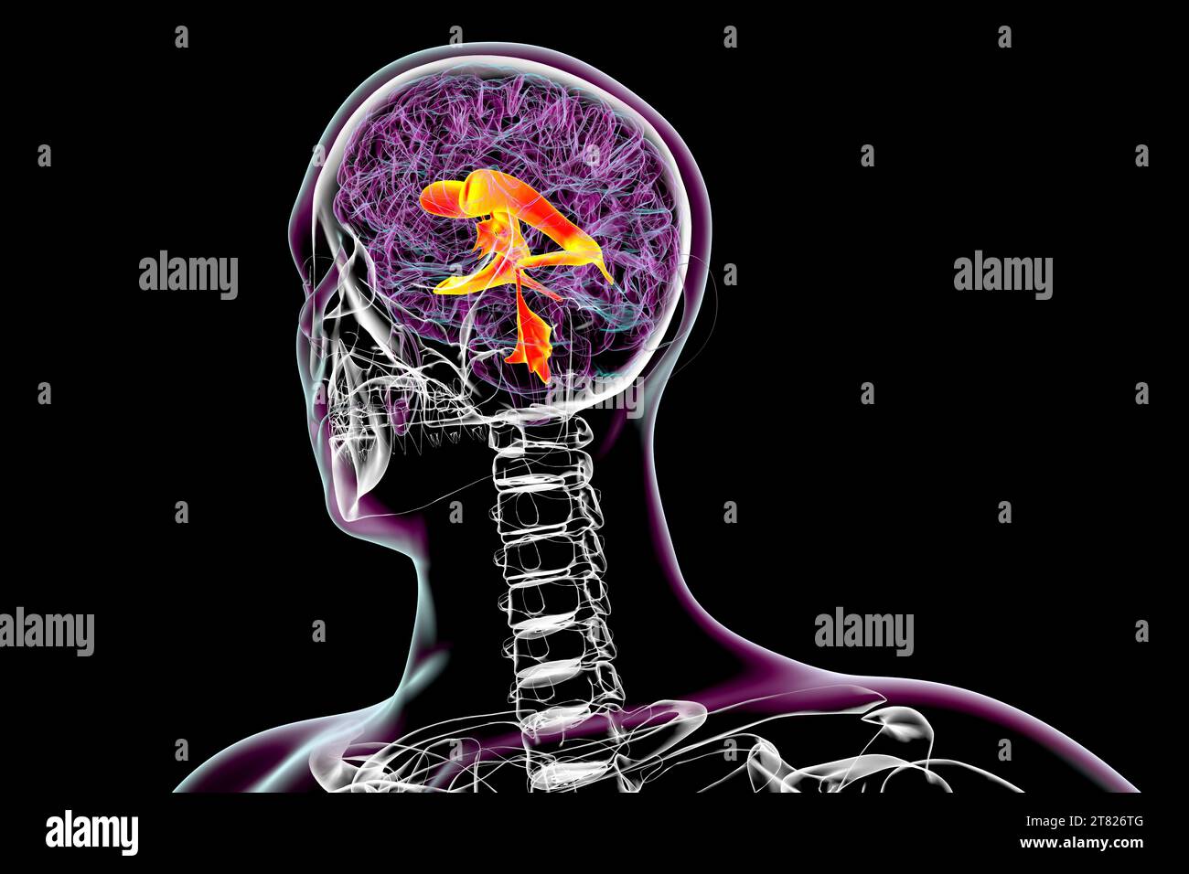 Ventricular system of the brain, illustration Stock Photo - Alamy