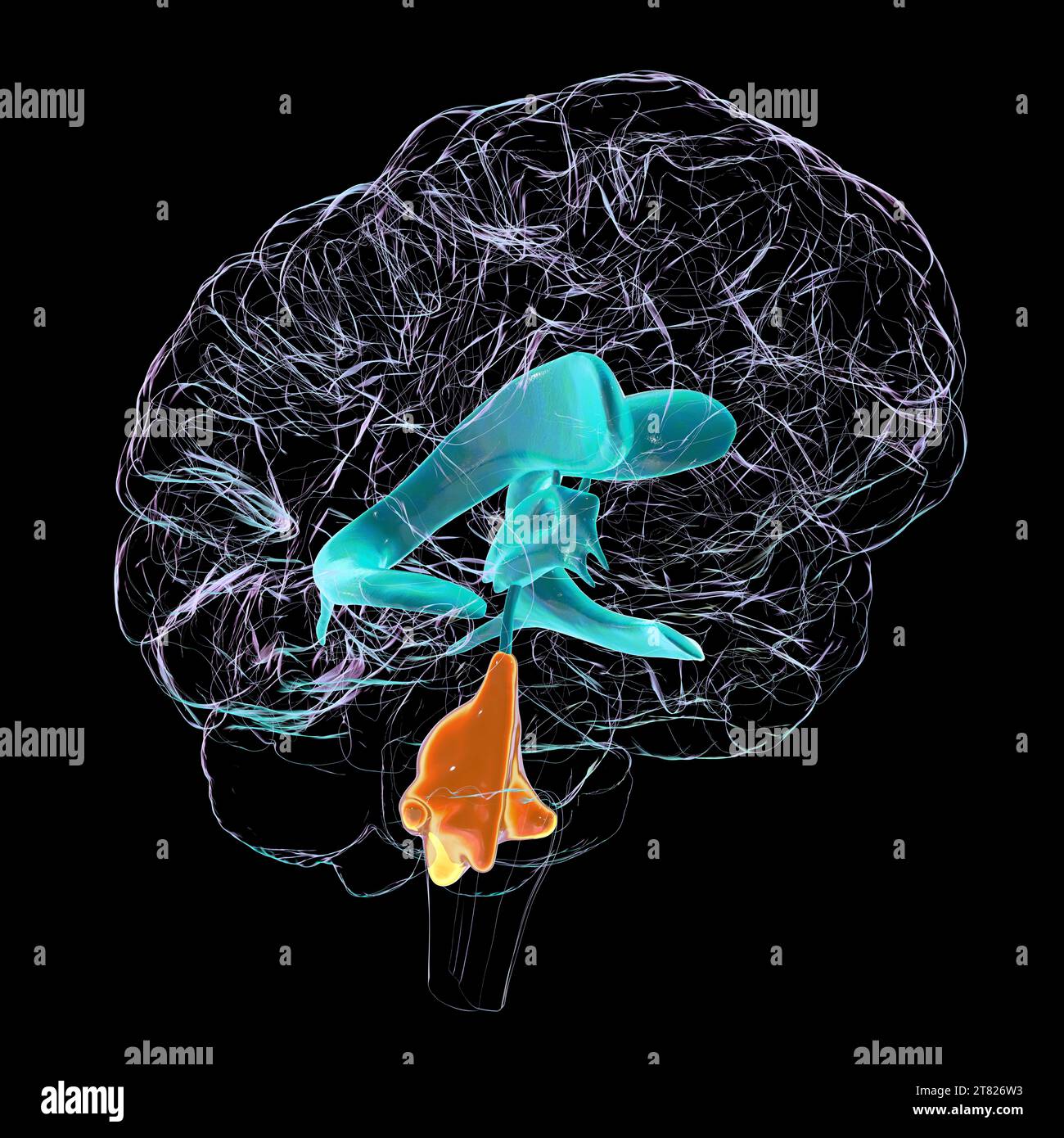 Enlarged fourth ventricle of the brain, illustration Stock Photo - Alamy