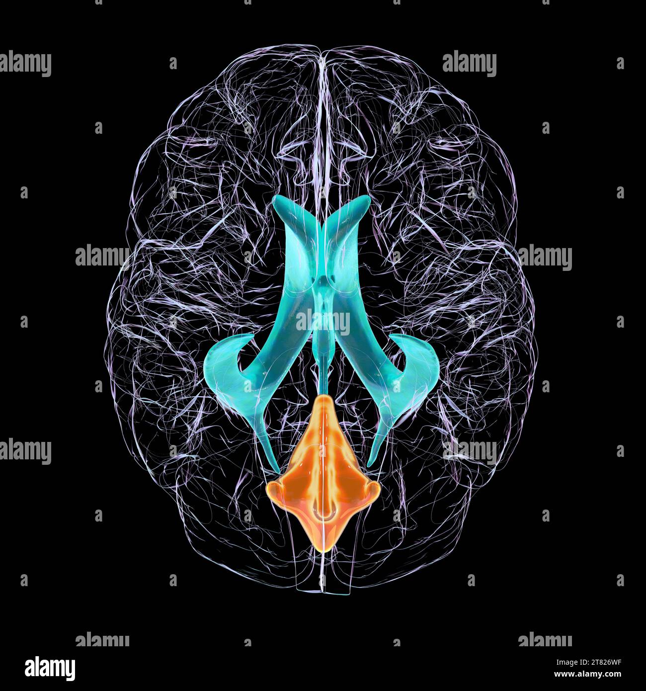 Enlarged fourth ventricle of the brain, illustration Stock Photo - Alamy