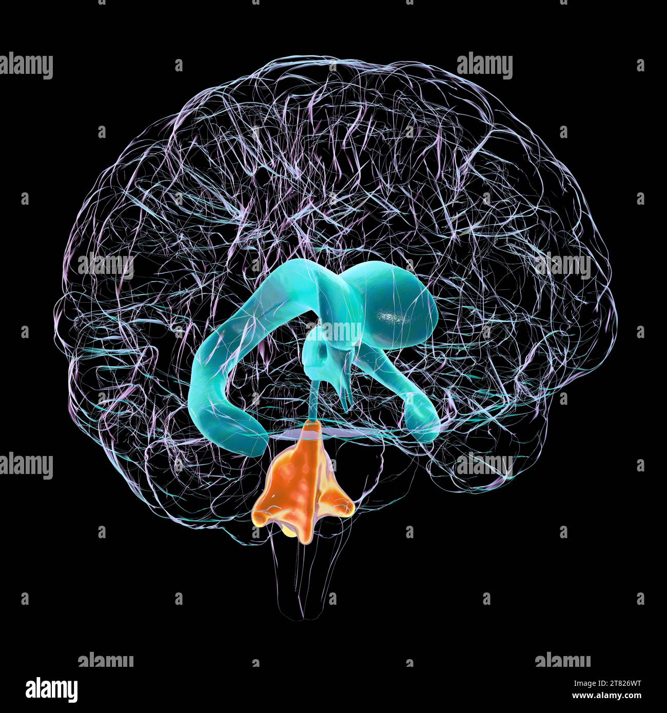 Enlarged fourth ventricle of the brain, illustration Stock Photo - Alamy