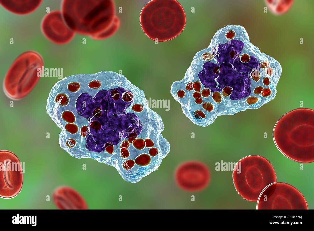 Histoplasmosis capsulatum histoplasma capsulatum hi-res stock ...