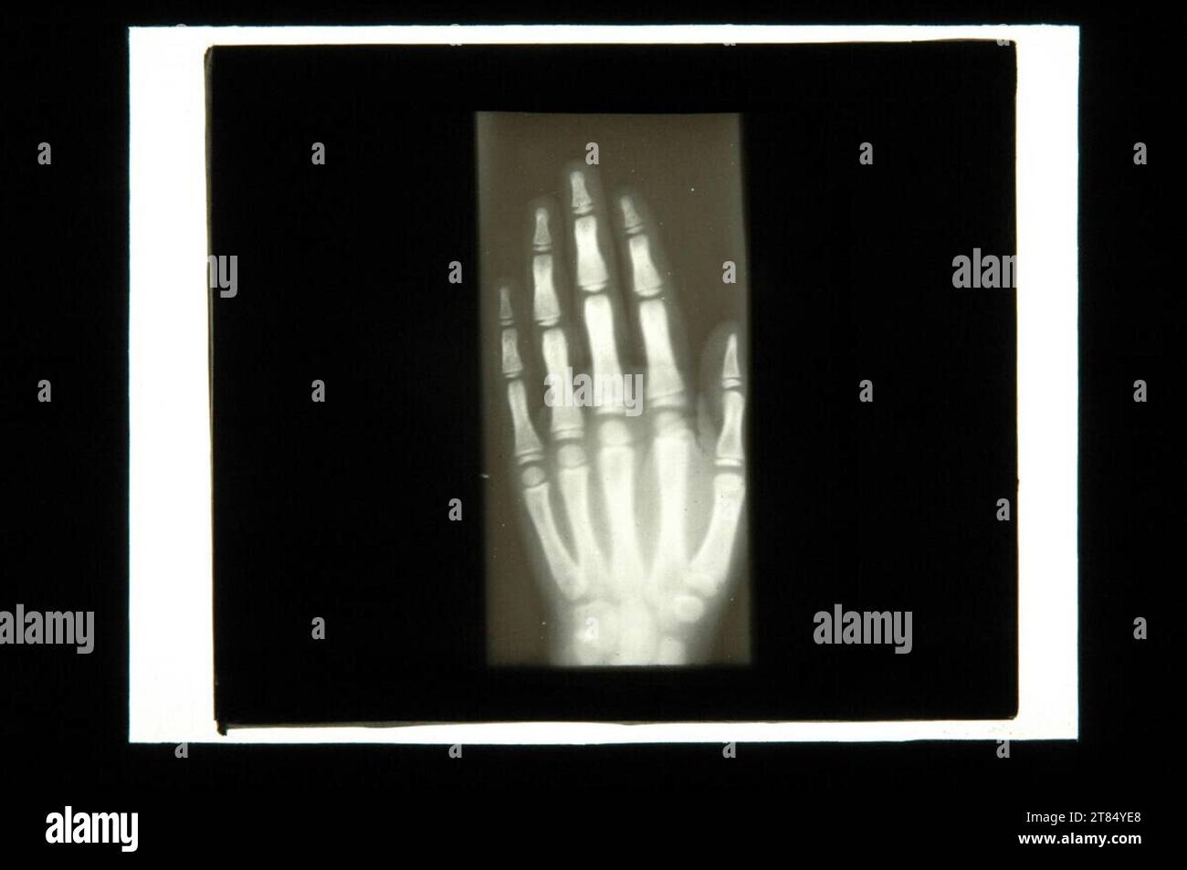 Josef Maria Eder Photography of the hand of an 8-year girl (remains of ...