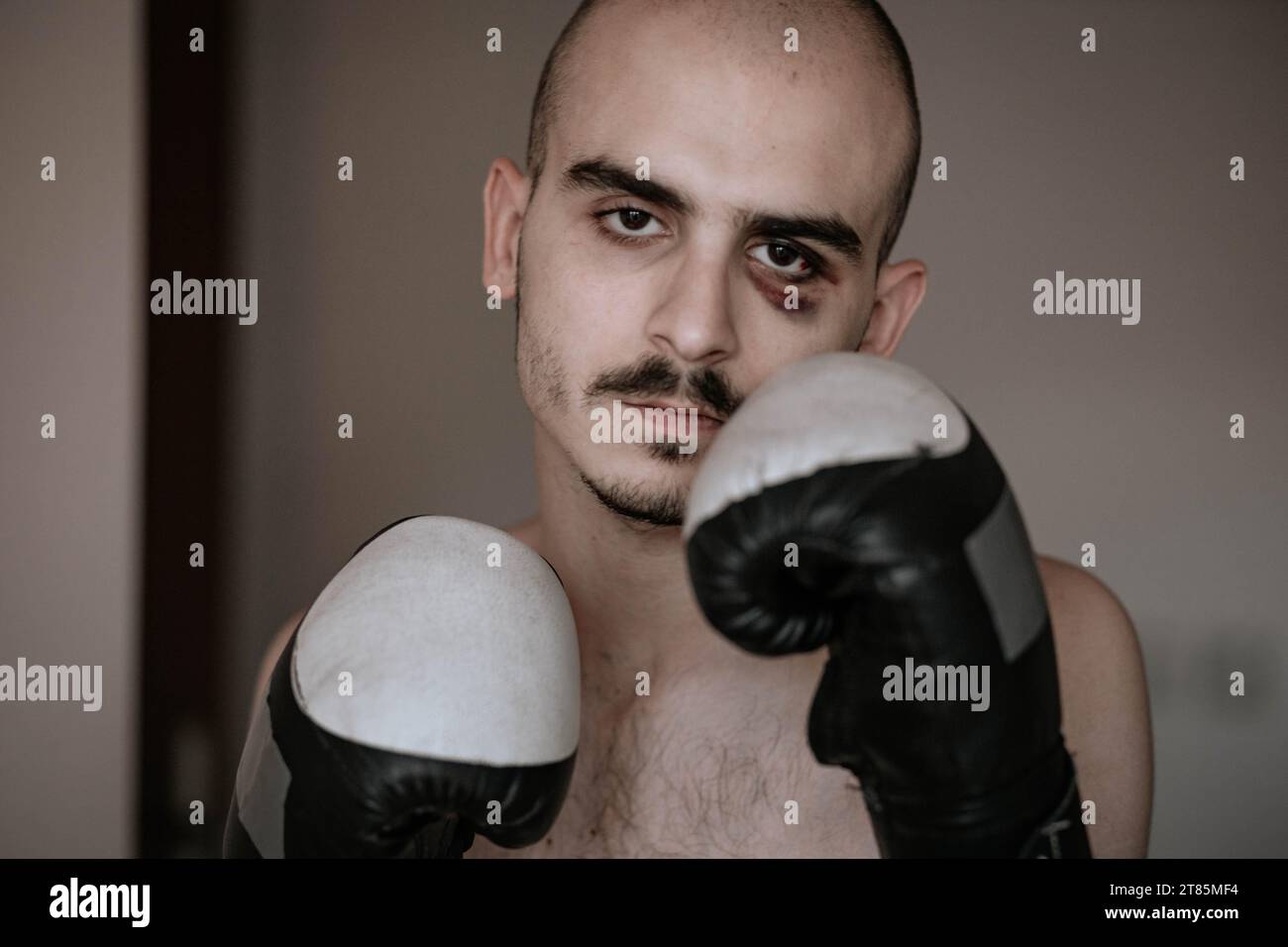 Young male with bruises on his face holding boxing gloves up in the air ...