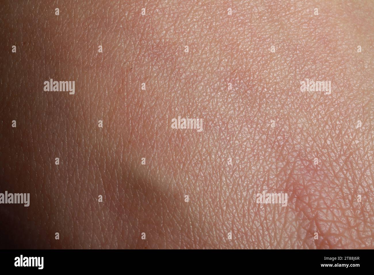 Closeup view of dry human skin as background Stock Photo - Alamy