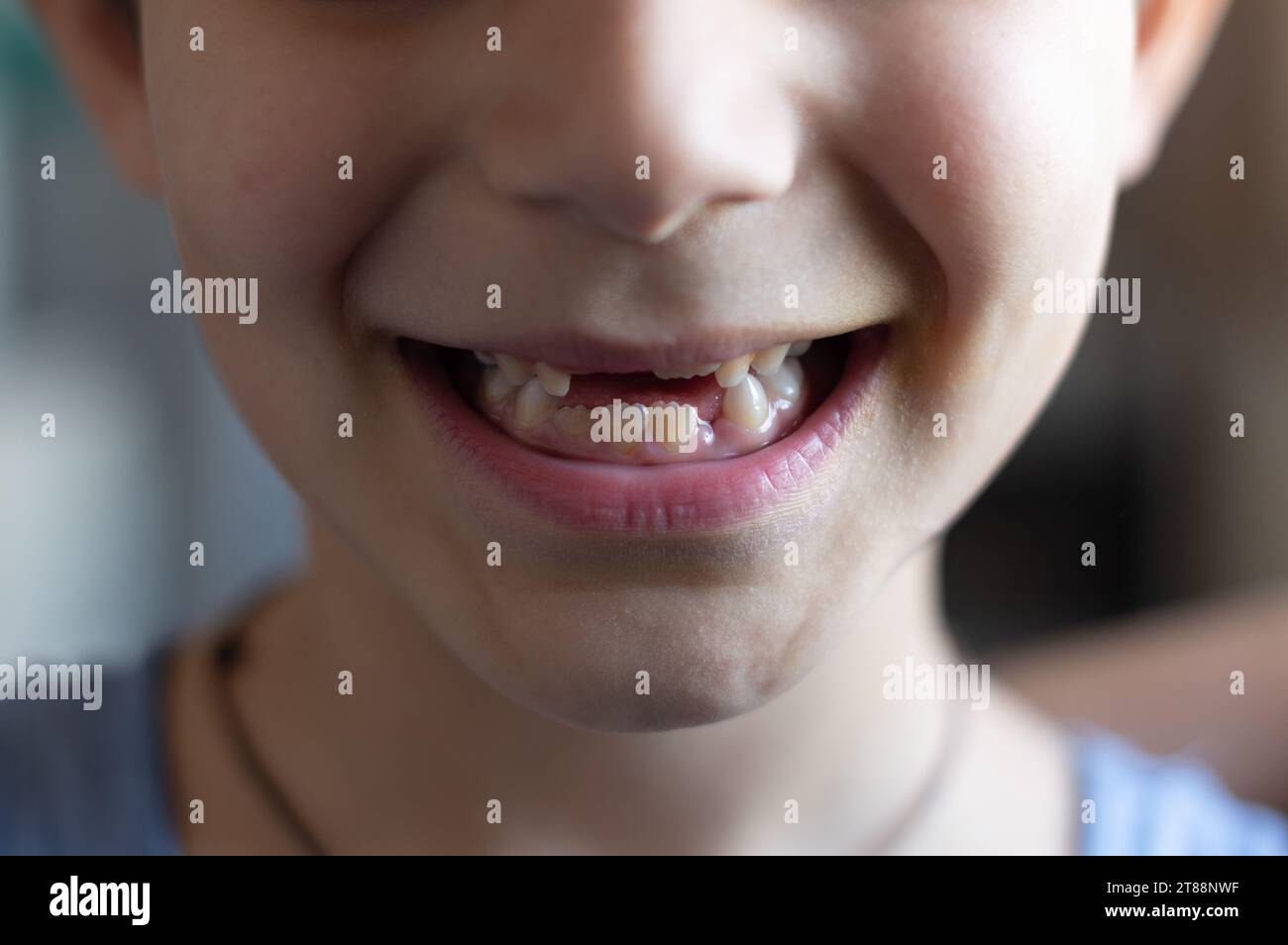 Real life style lower face closeup shot of the smiling Caucasian boy ...