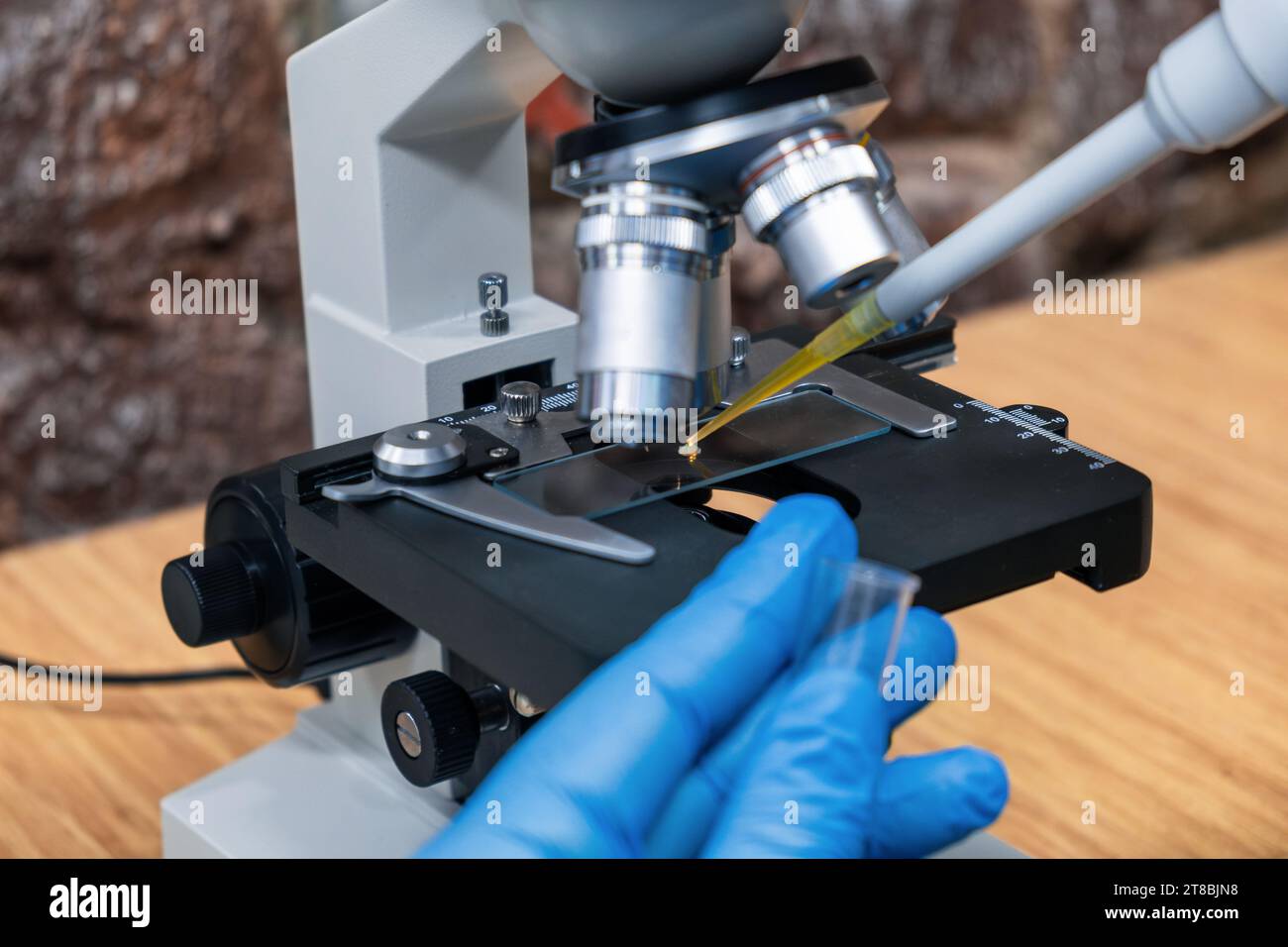 Doctor dripping urine from a pipette onto glass under microscope to ...