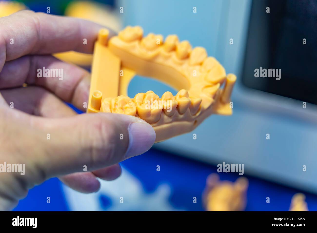 Dental technician modeling frame for implant production from a 3d ...