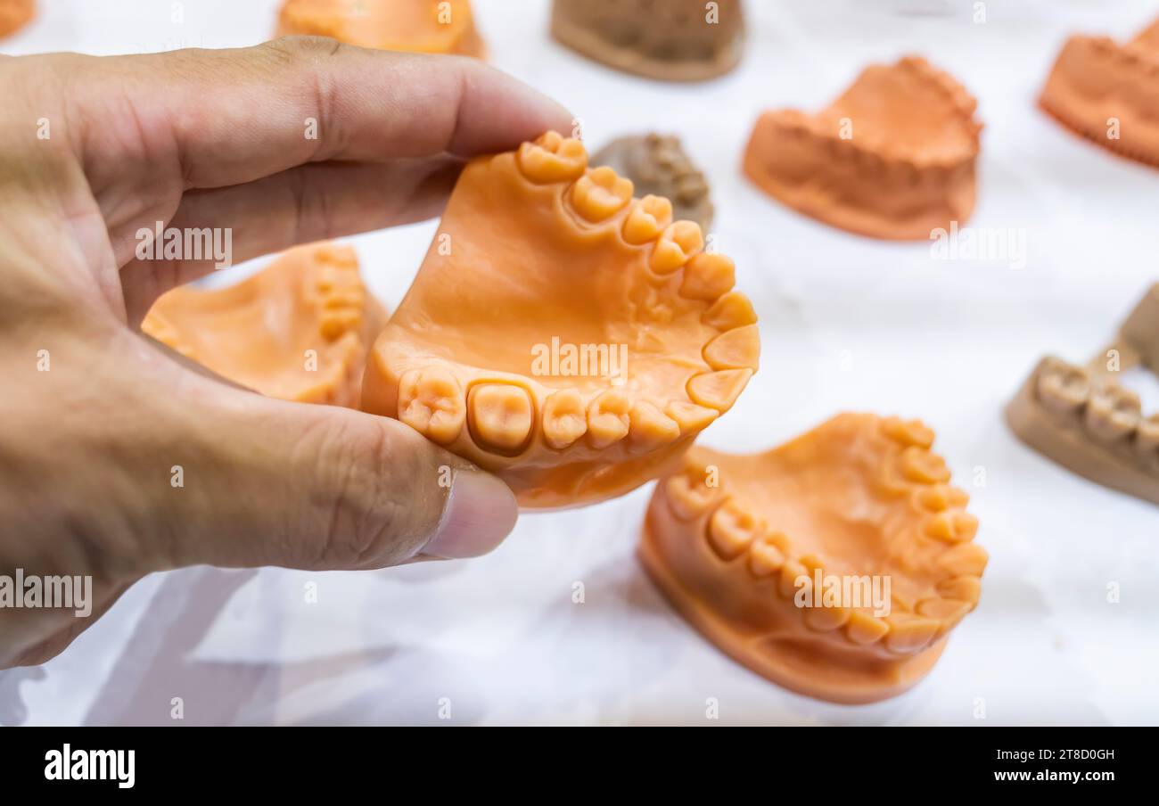 Dental technician modeling frame for implant production from a 3d ...