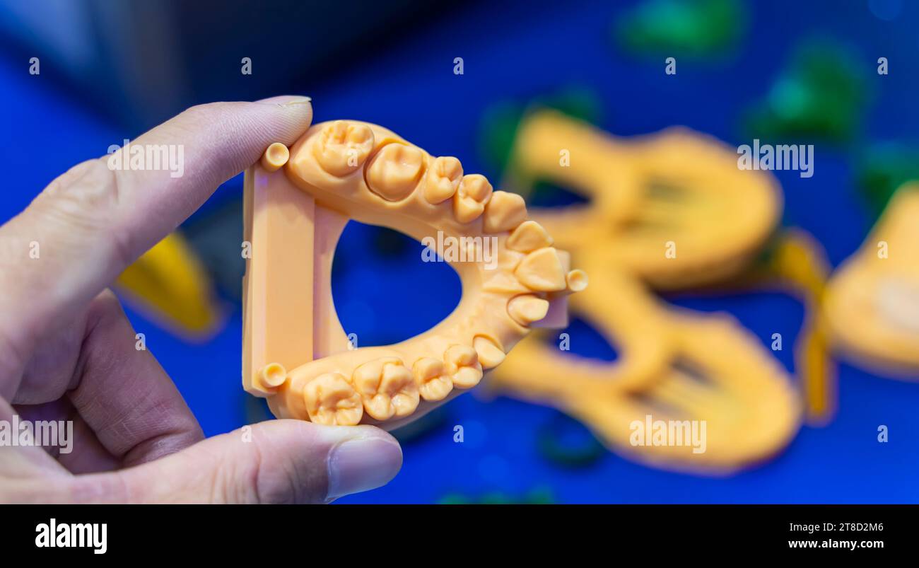 Dental technician modeling teeth frame for implant production from a 3d ...
