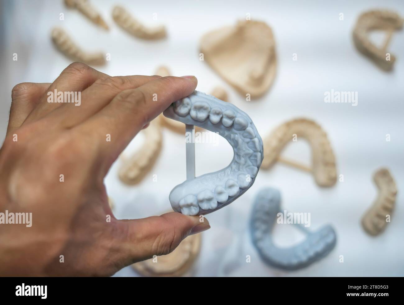 Dental technician modeling frame for implant production from a 3d ...