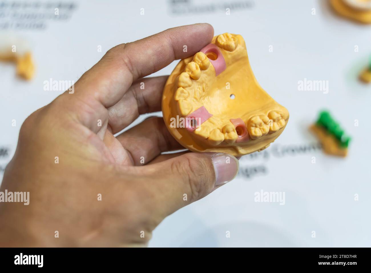 Denture modeling hi-res stock photography and images - Alamy