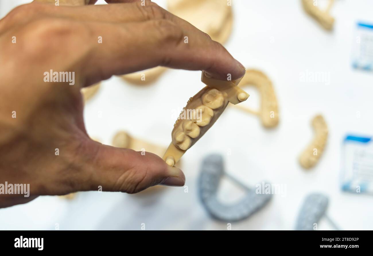 Dental technician modeling frame for implant production from a 3d ...