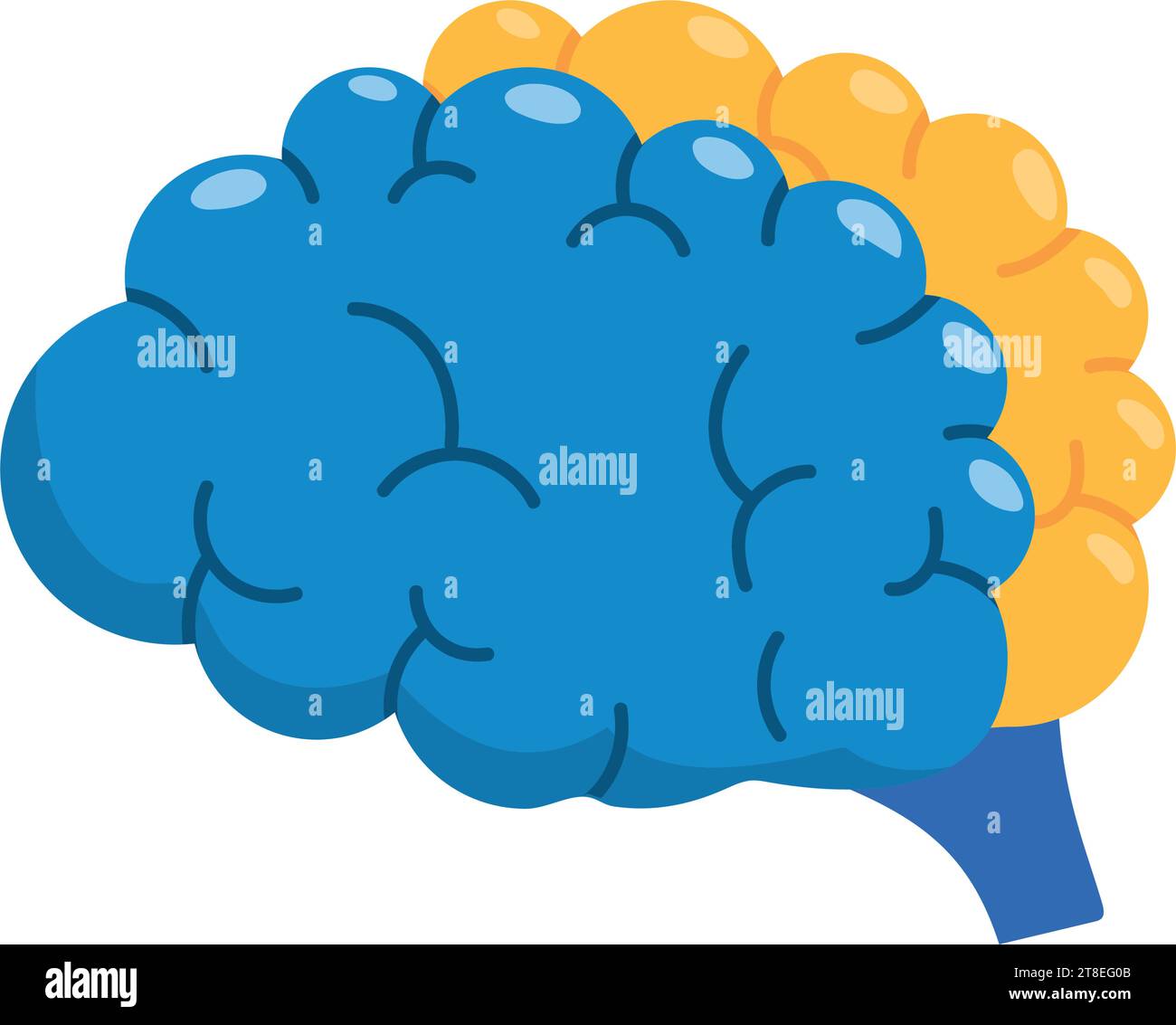 down syndrome brain condition Stock Vector Image & Art - Alamy