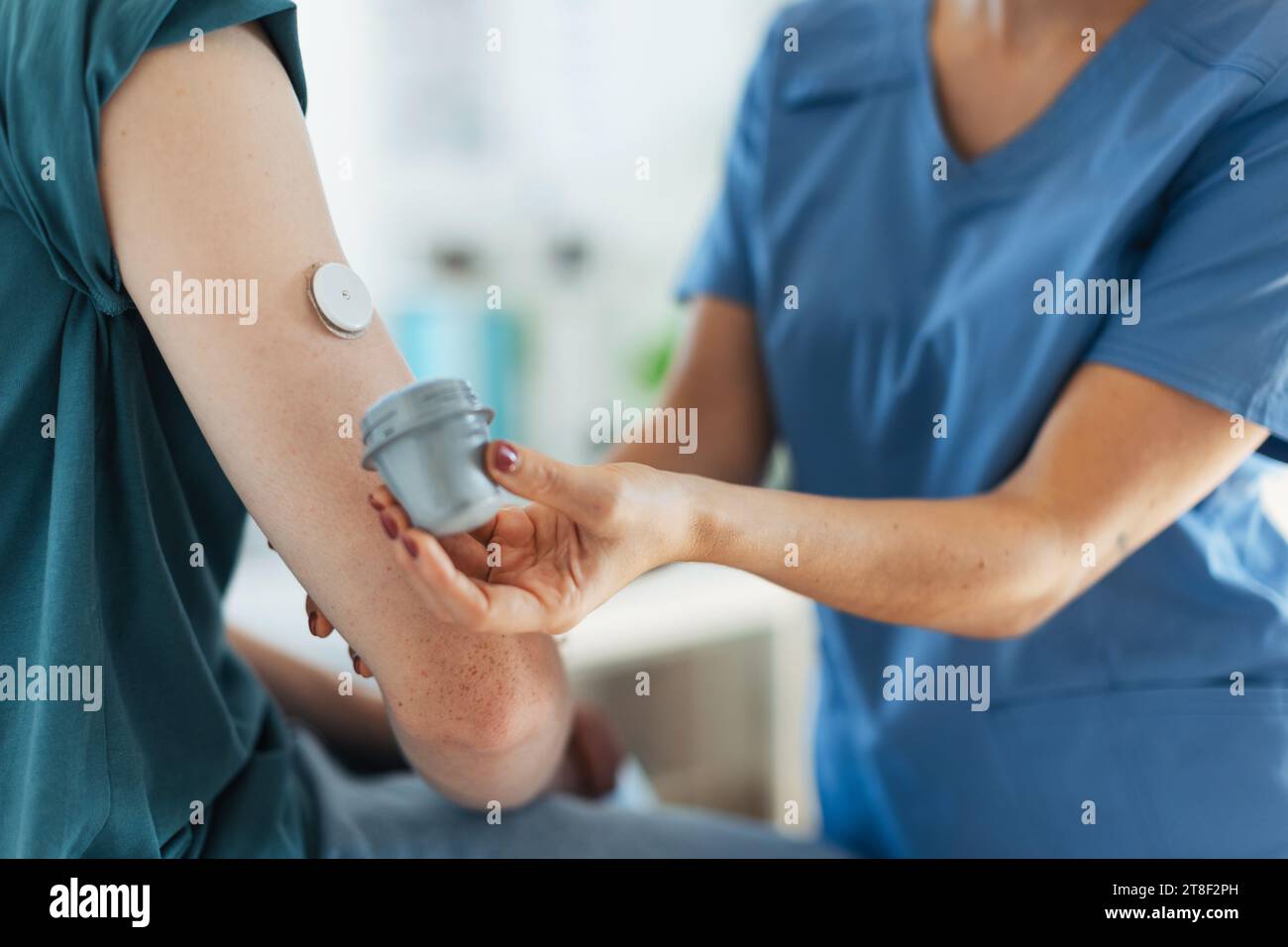 Nurse applying a continuous glucose monitor sensor on arm of a diabetic ...