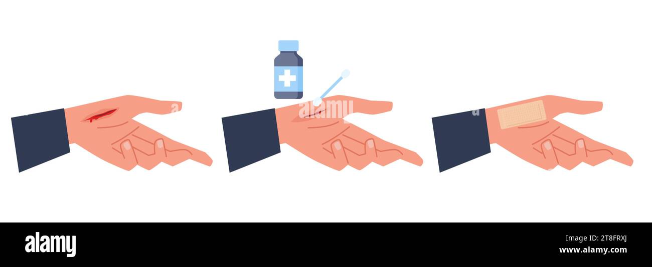 First aid for treating cut wound on hand. Treatment stages process for bleeding arm. Trauma ...