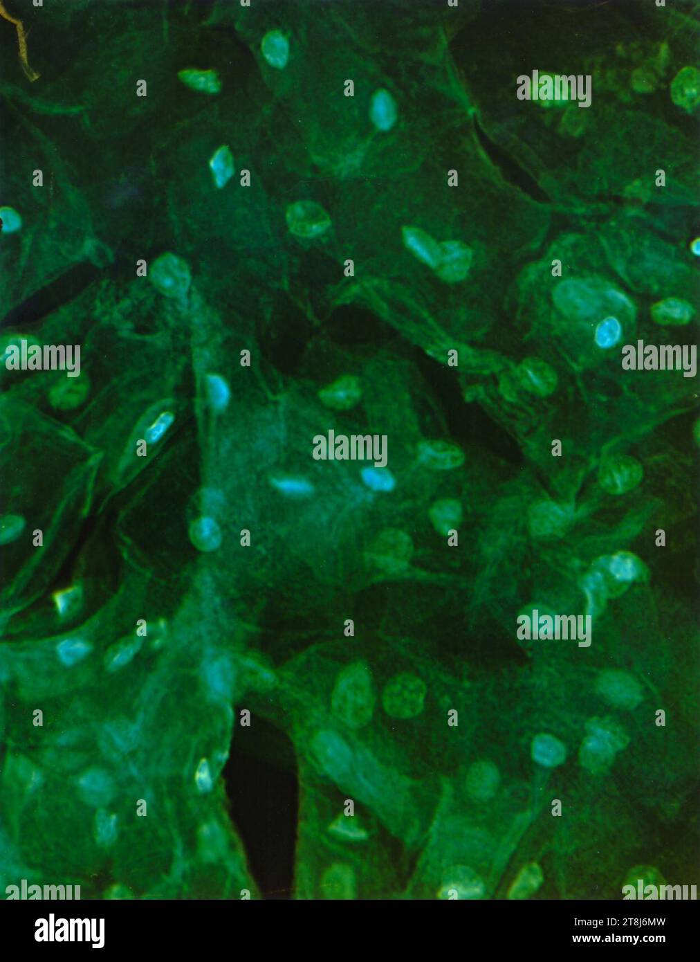 Normal uterus hi-res stock photography and images - Alamy