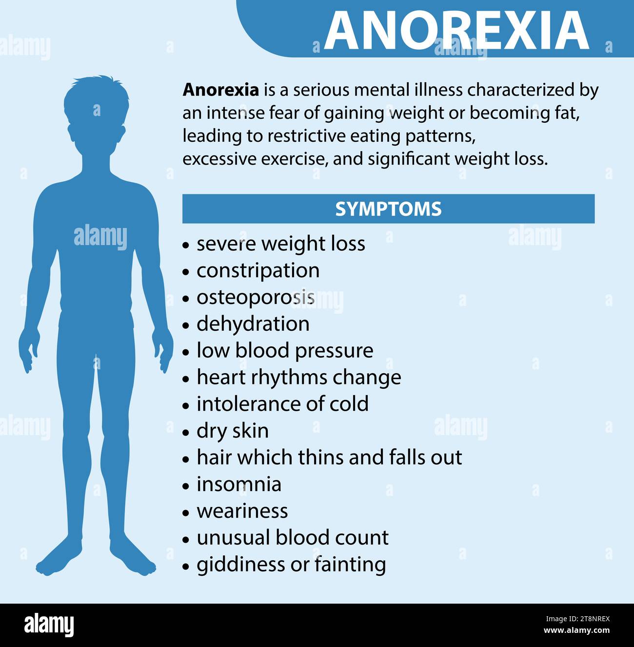 A medical poster illustrating symptoms of anorexia in males Stock ...