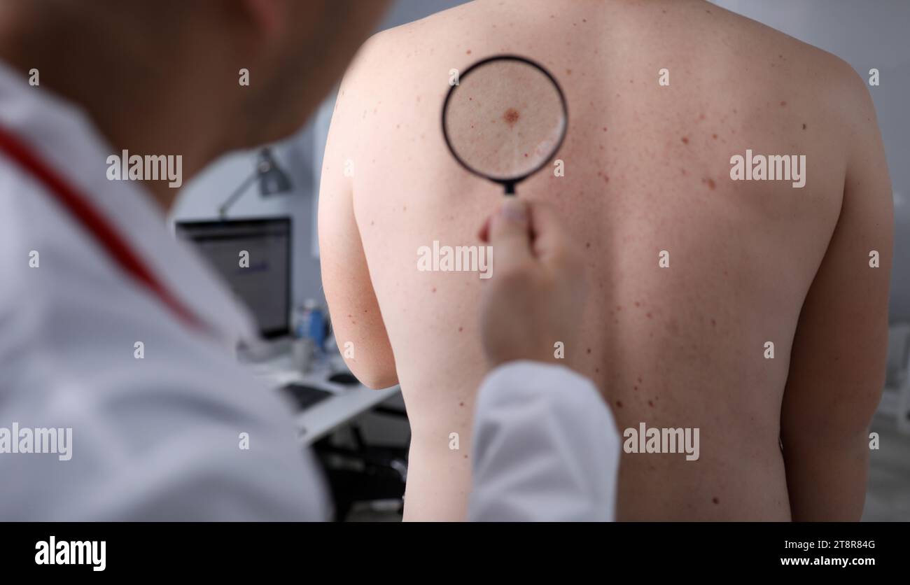 Male doctor look at magnifying glass on patient skin Stock Photo - Alamy