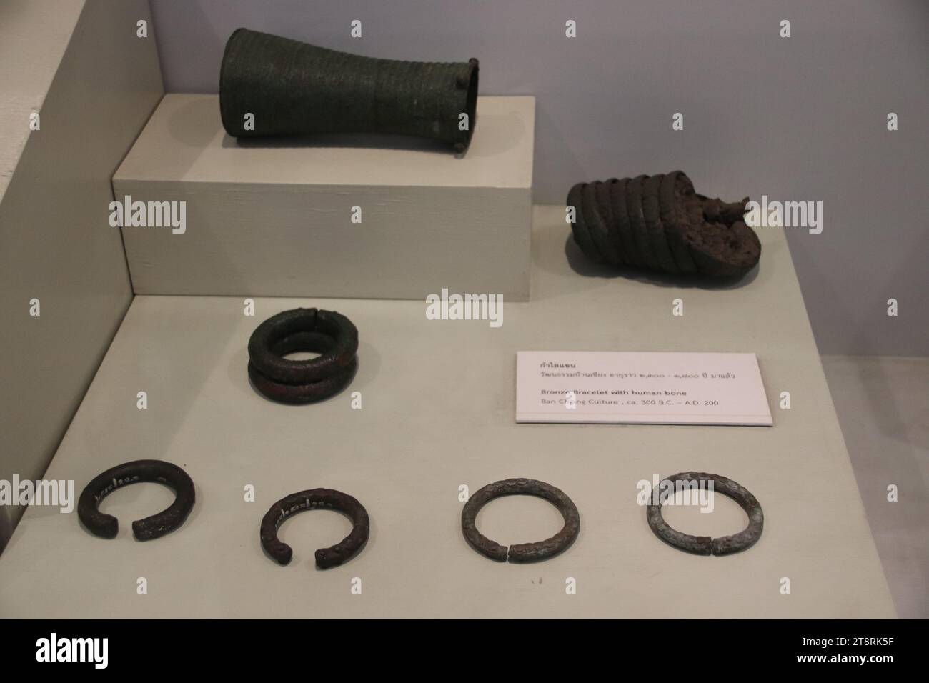 Bronze Bracelet with Human Bone, Ban Chiang Culture, 300 BC to 200 AD ...