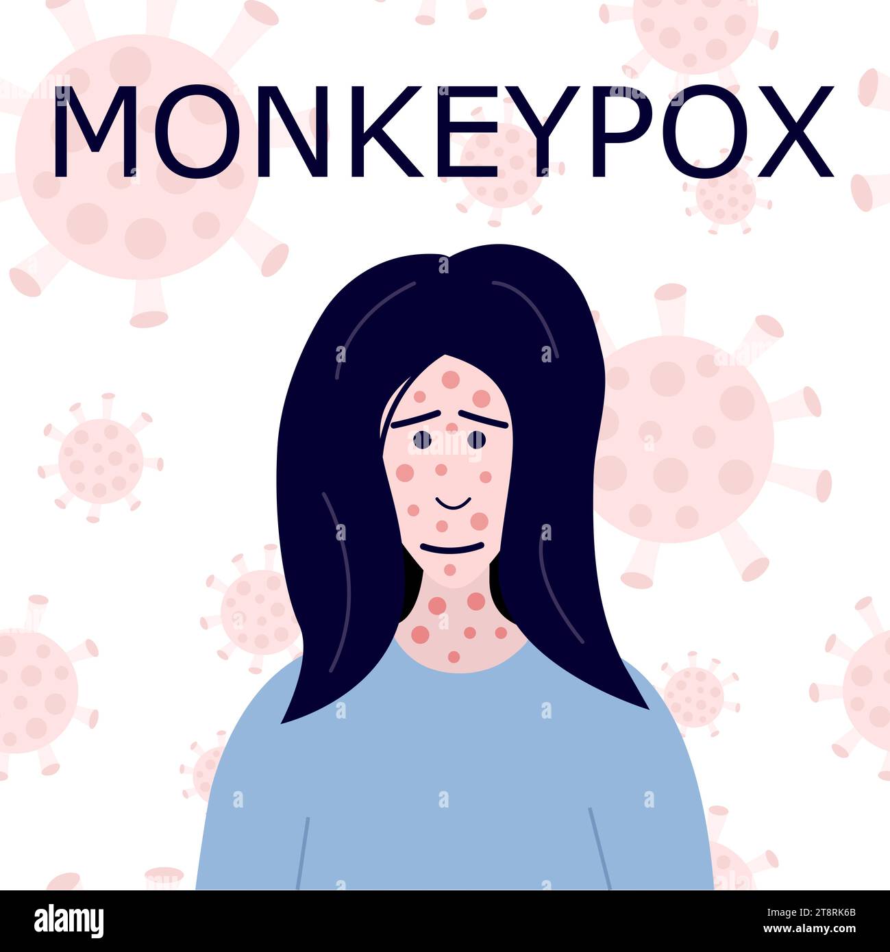 Monkey pox outbreak Stock Vector Image & Art - Alamy