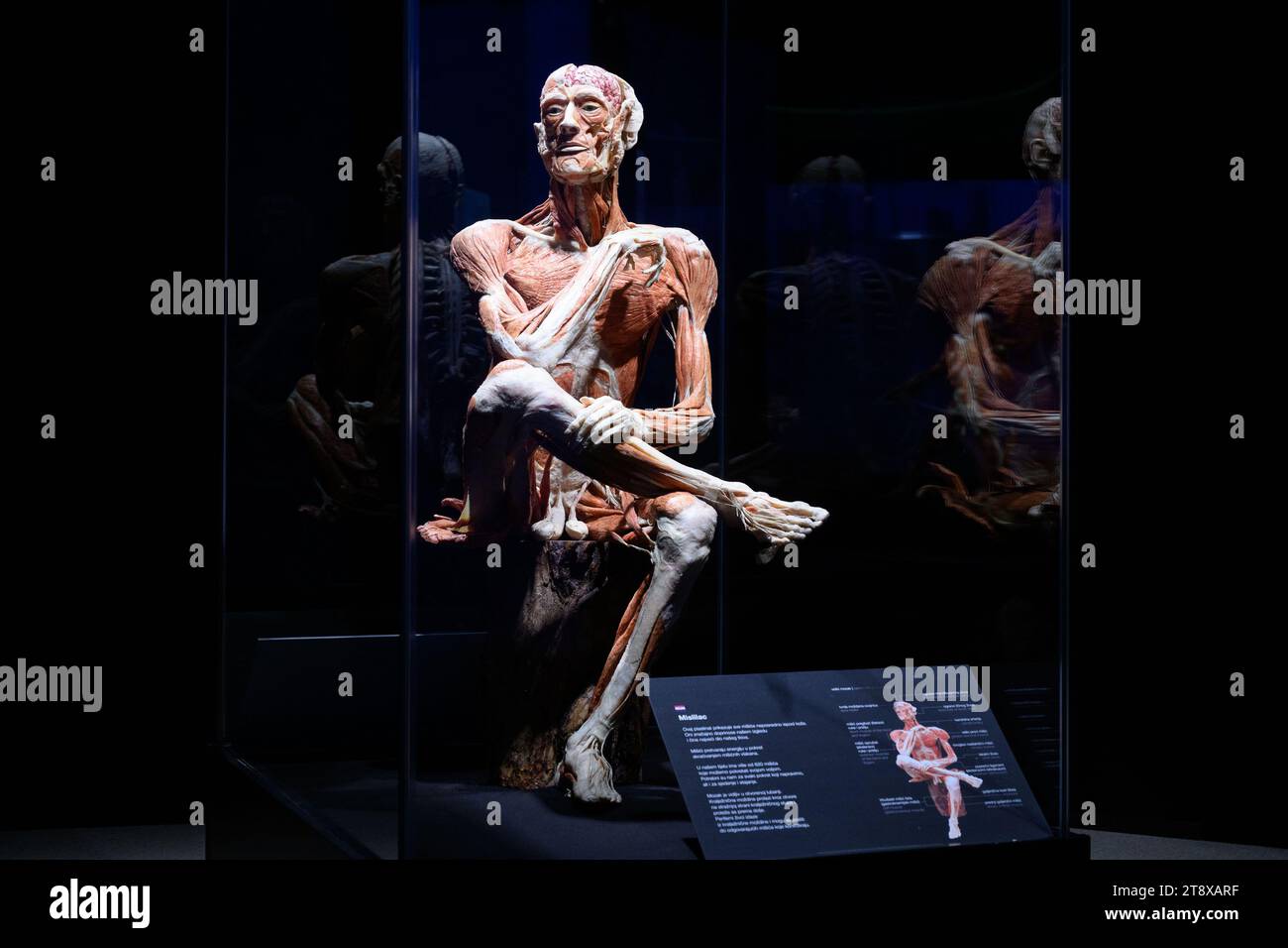 Zagreb, Croatia. 21st Nov, 2023. A plastinate is on a disply during the ...