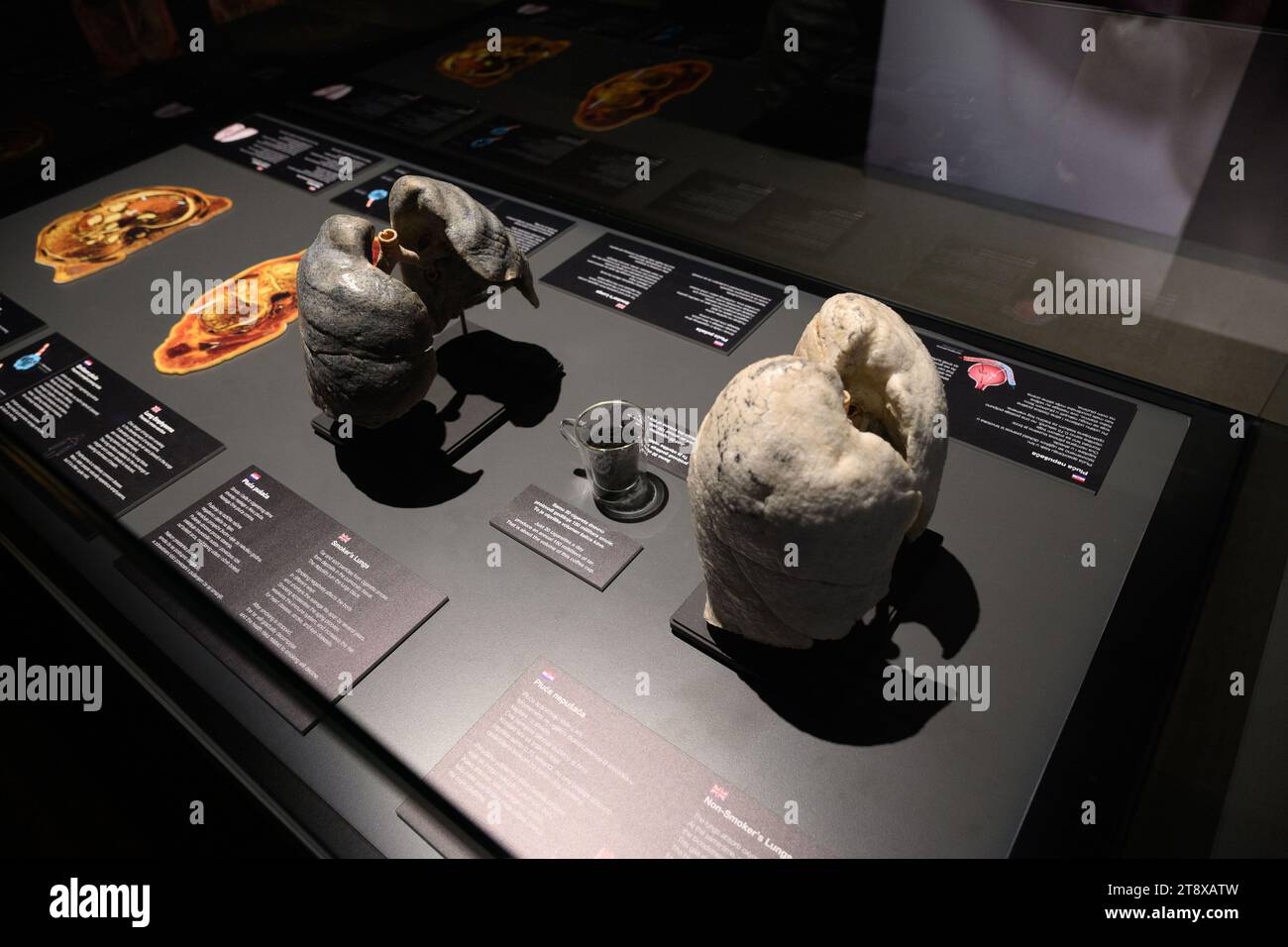 Zagreb, Croatia. 21st Nov, 2023. A plastinate is on a disply during the ...