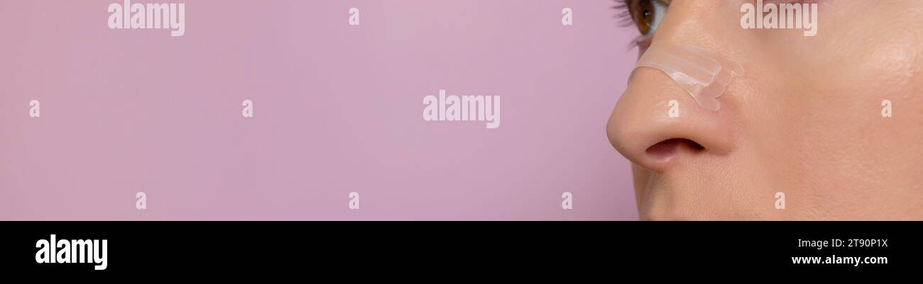 Banner Closeup Nasal Strip on Female Nose on Pink Background. Adhesive ...