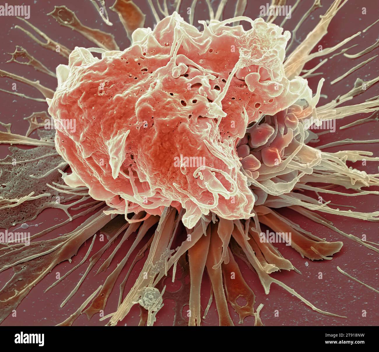 Chemotherapy induced cell death, SEM Stock Photo - Alamy