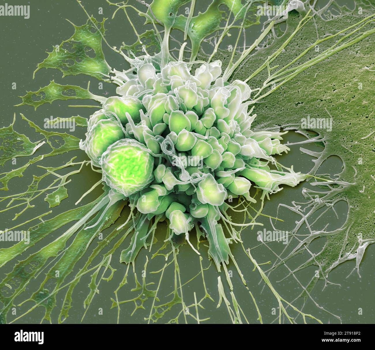 Chemotherapy induced cell death, SEM Stock Photo - Alamy