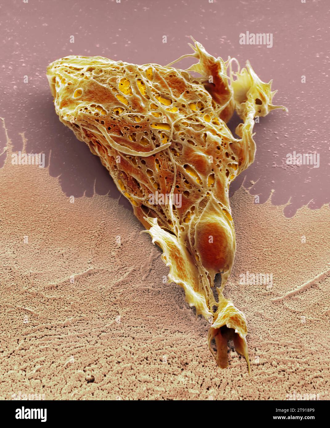 Chemotherapy induced cell death, SEM Stock Photo - Alamy