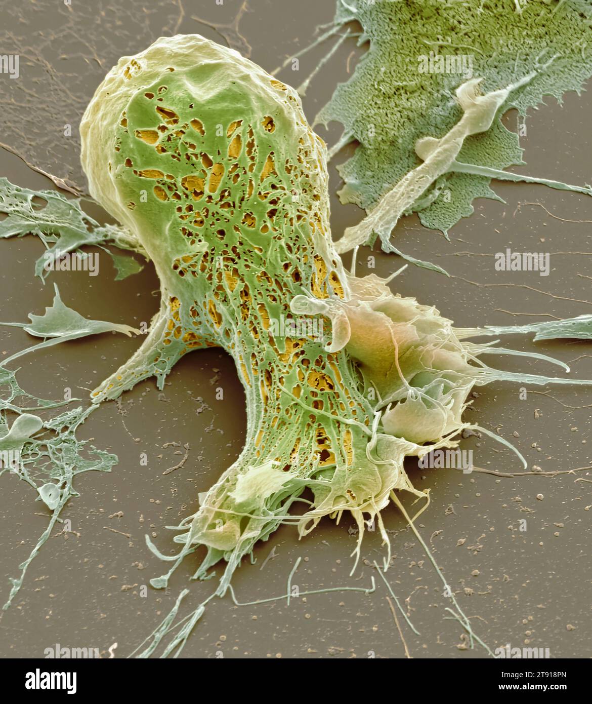 Chemotherapy induced cell death, SEM Stock Photo - Alamy