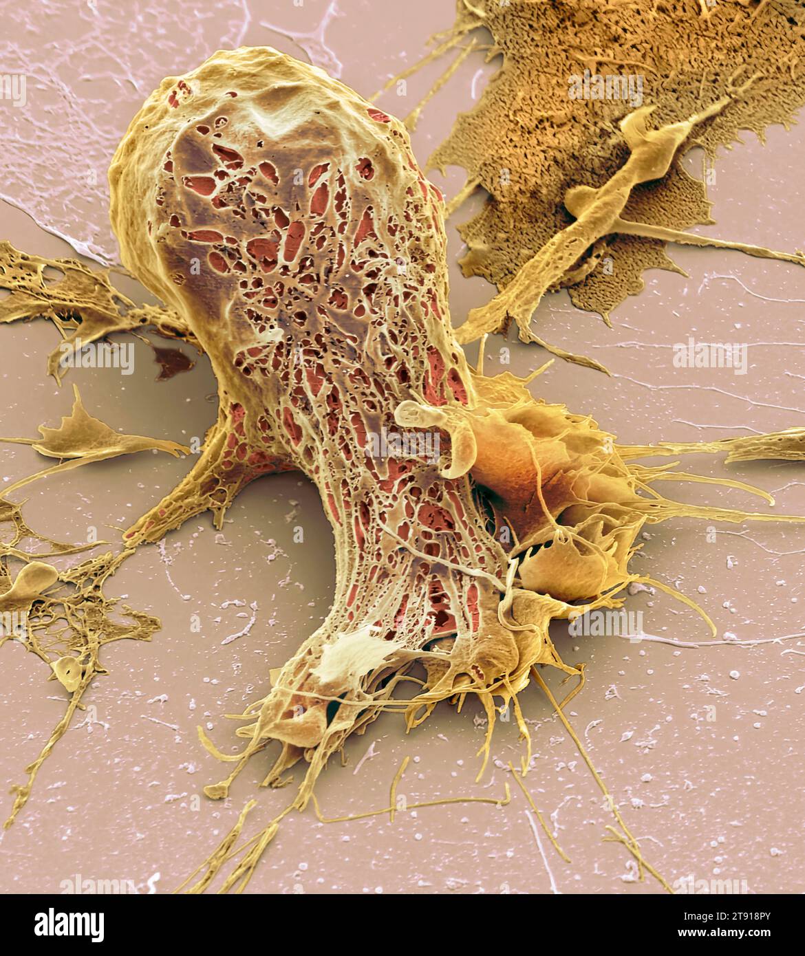 Chemotherapy induced cell death, SEM Stock Photo - Alamy