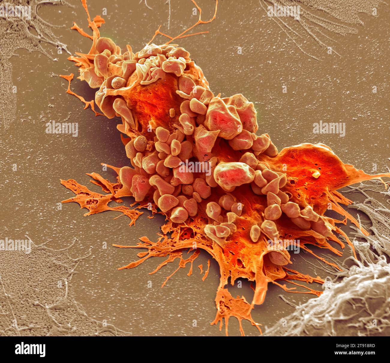 Chemotherapy induced cell death, SEM Stock Photo - Alamy