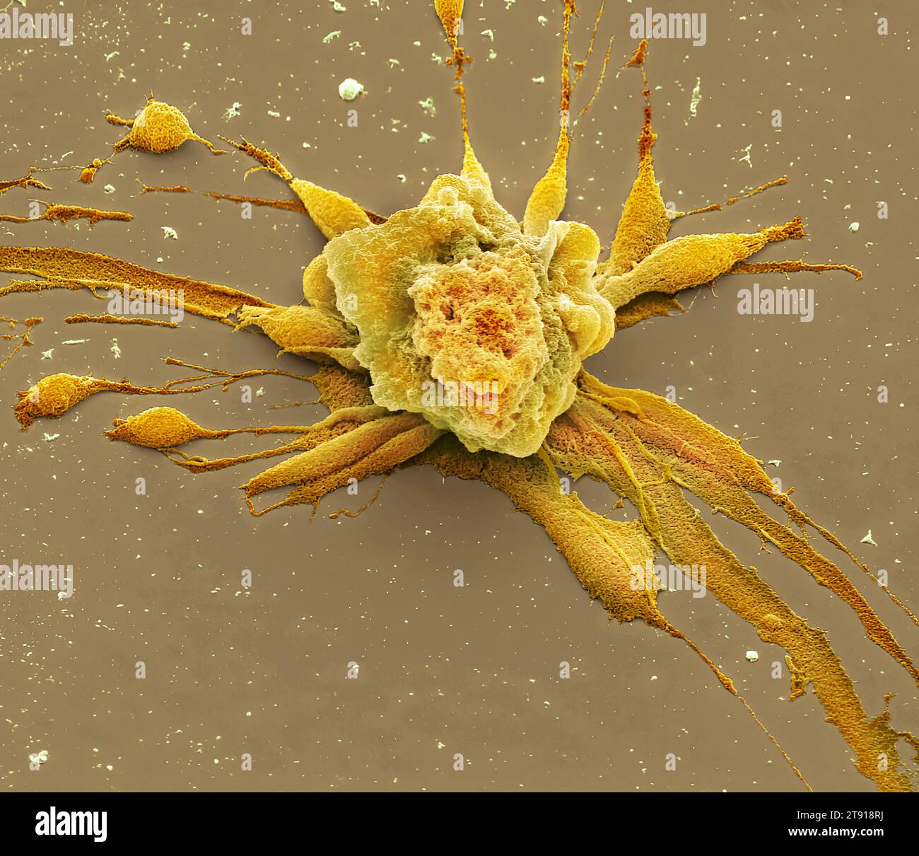Chemotherapy induced cell death, SEM Stock Photo - Alamy