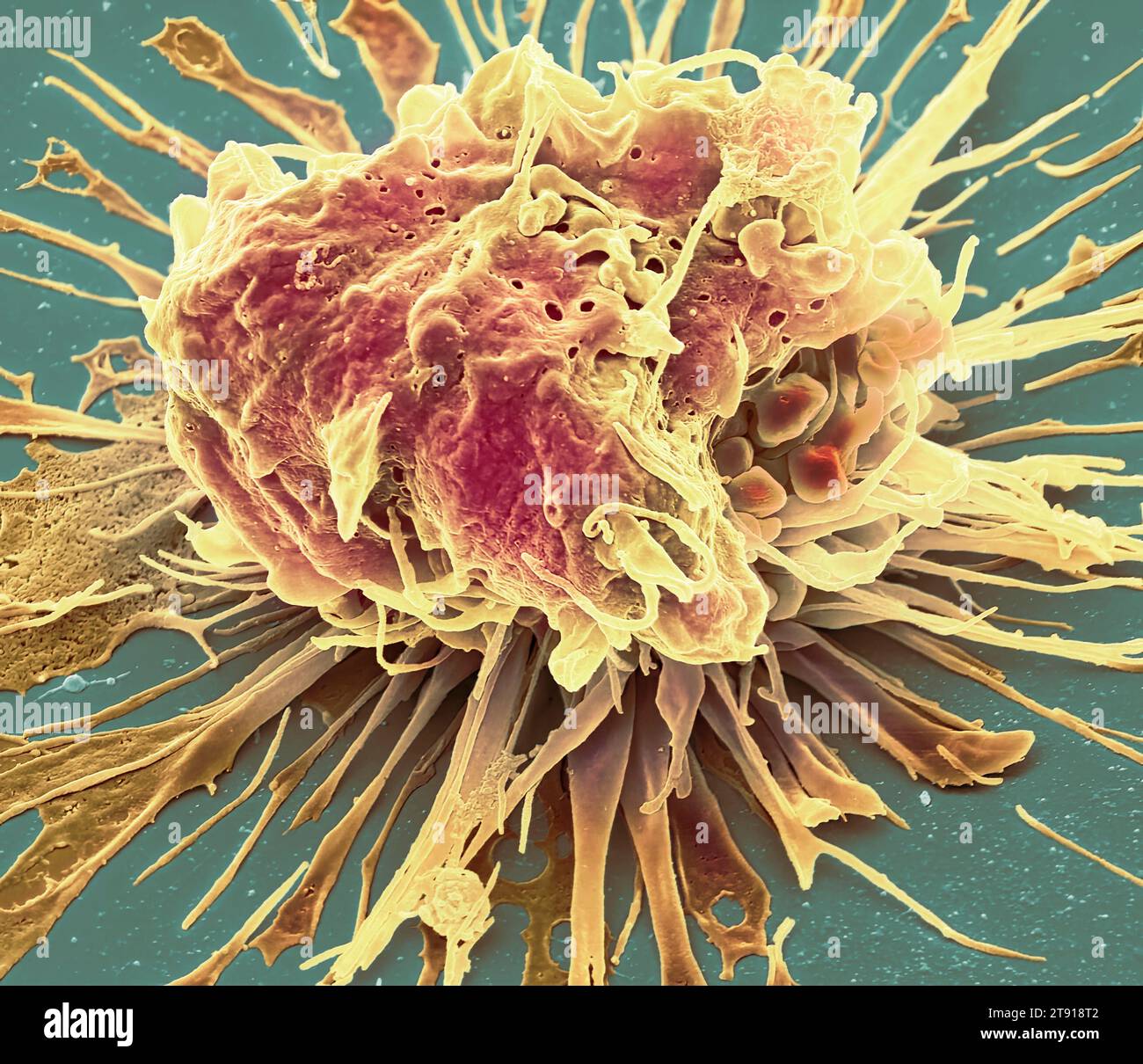 Chemotherapy induced cell death, SEM Stock Photo - Alamy