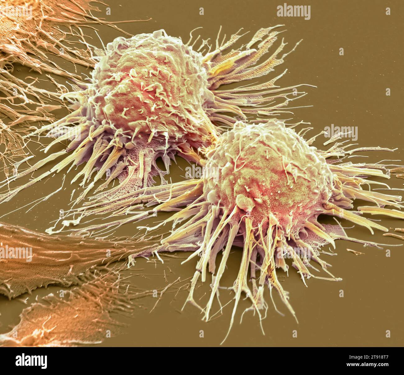Dividing HeLa cells, SEM Stock Photo - Alamy