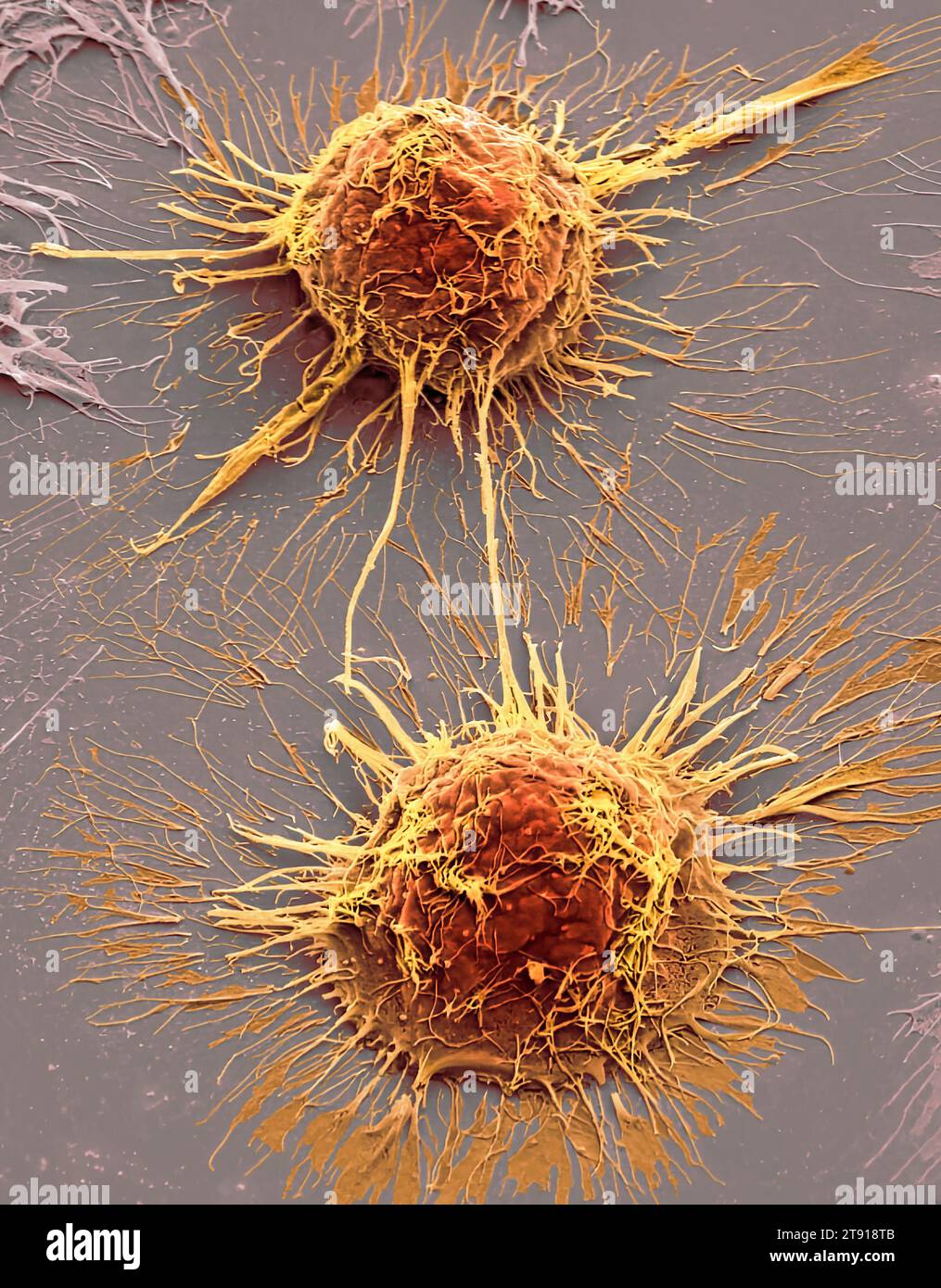 Dividing HeLa cells, SEM Stock Photo - Alamy