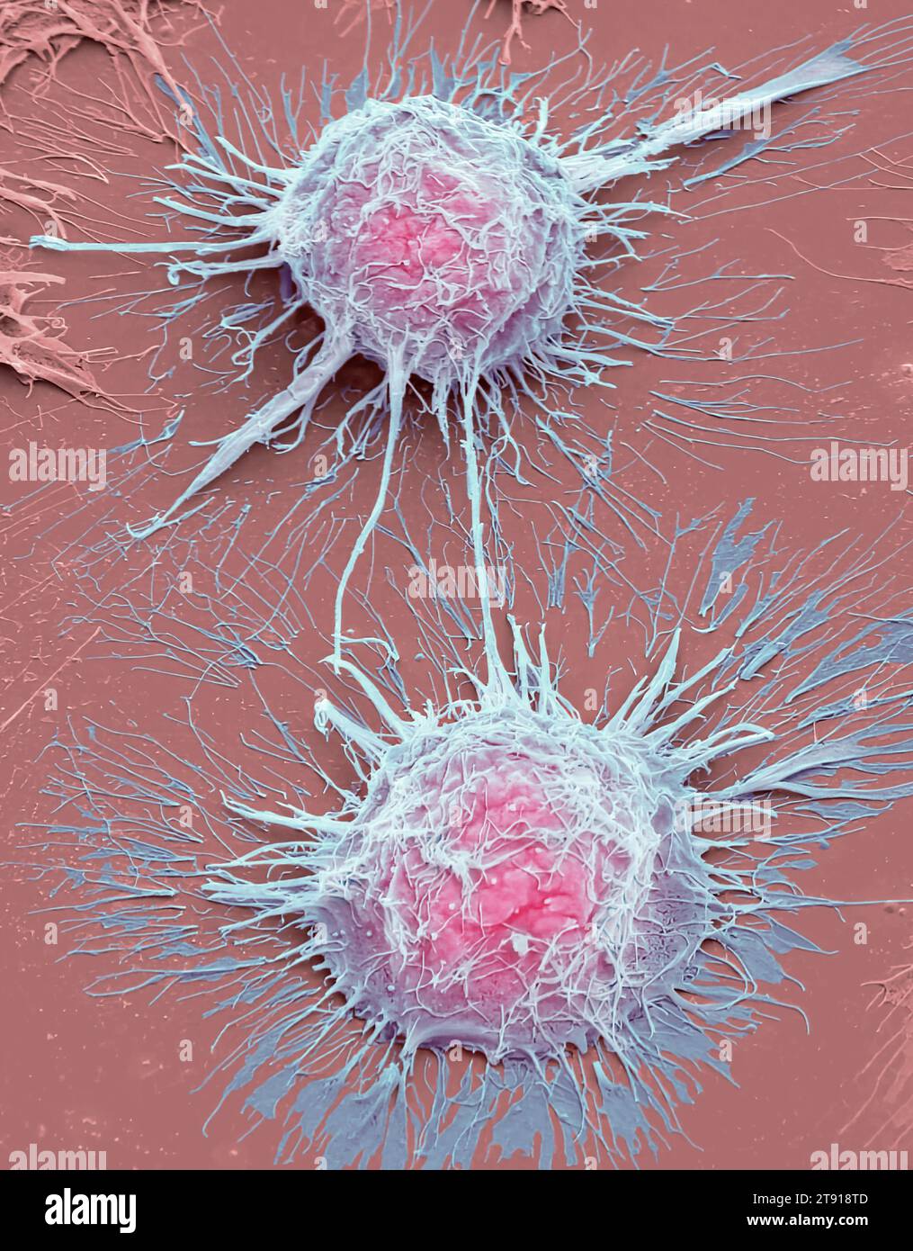 Dividing HeLa cells, SEM Stock Photo - Alamy