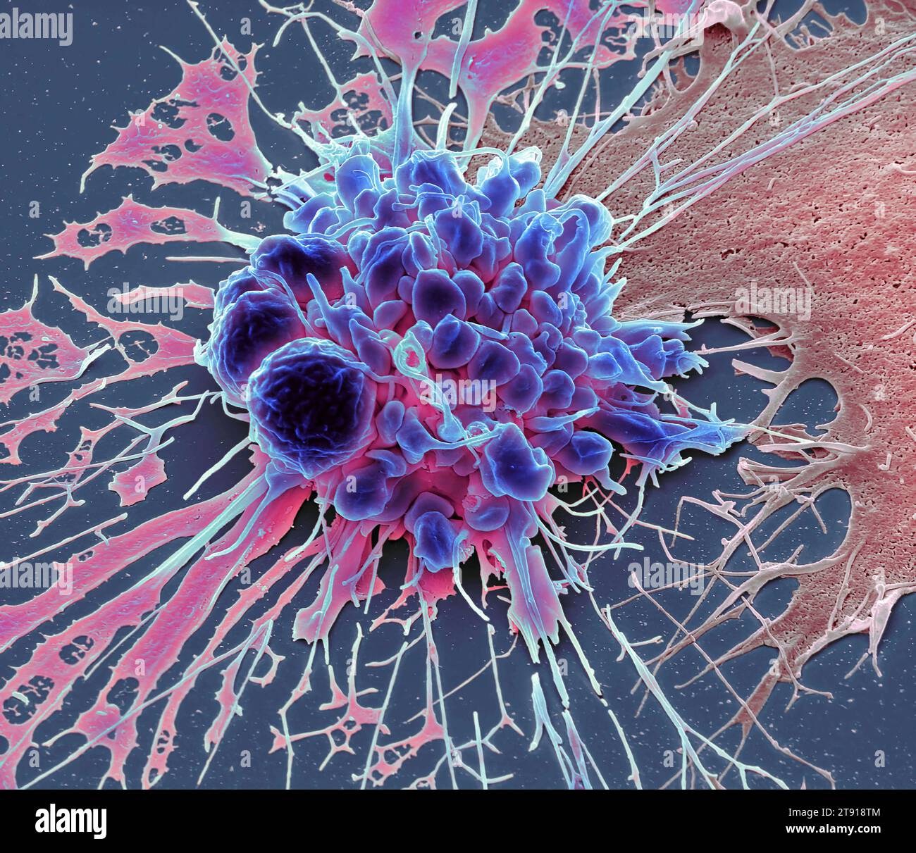 Chemotherapy induced cell death, SEM Stock Photo - Alamy